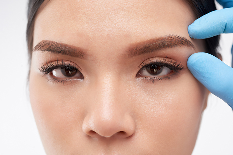 What is a Fox Eye/Cat Eye Lift? A Brief Overview